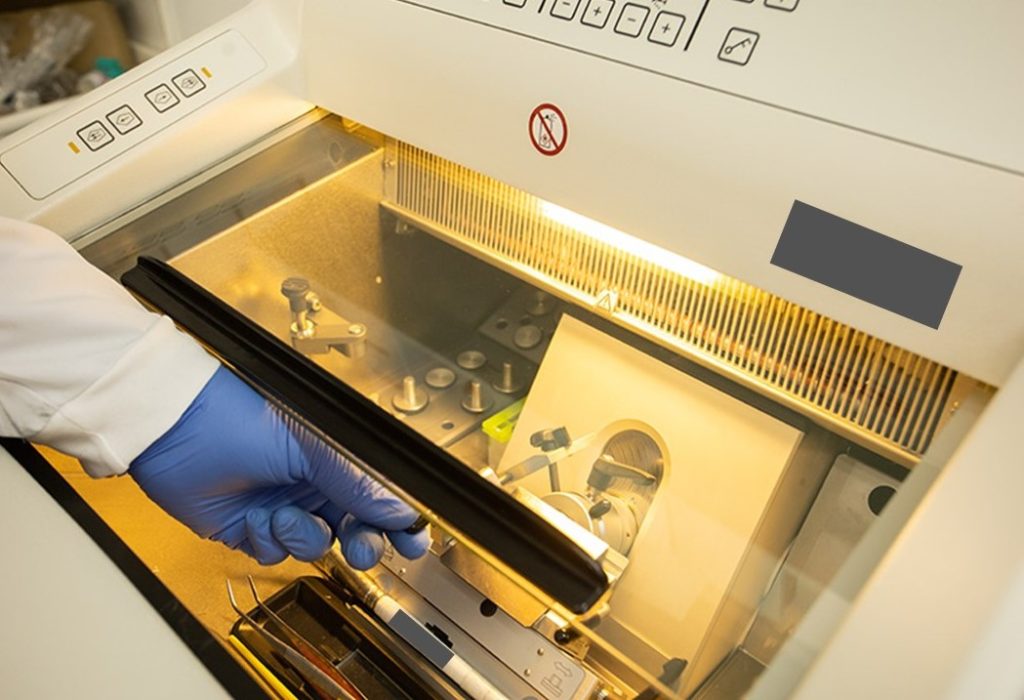 Exames Peroperatórios por Congelamento