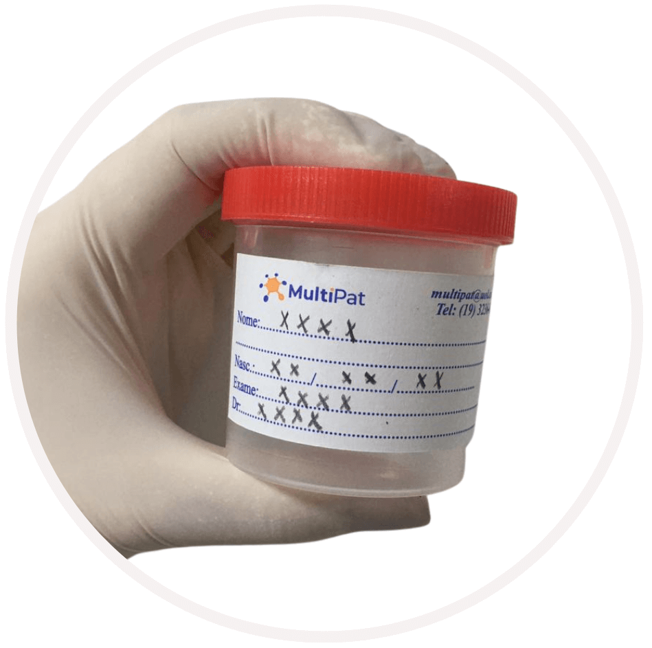 Como Enviar - Multipat - Laboratório médico privado que presta diagnósticos de Anatomia ...